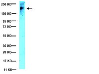 Anti-CFTR Antibody, clone MM13-4 | 05-581